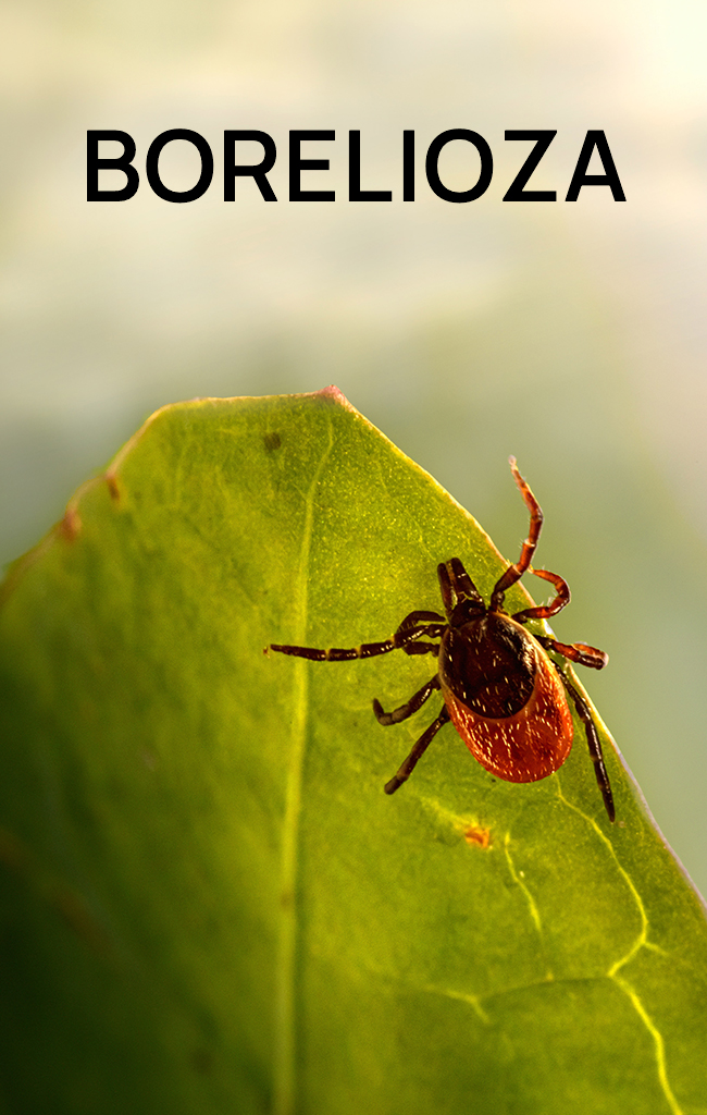 Borelioza w pigułce. Jak rozpoznać i leczyć? - tzf.health
